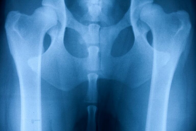 Hip Dysplasia in Dogs: What You Need to Know - The Ladies Working Dog Group